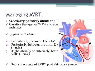 Managing supraventricular tachyarrythmias | PPT