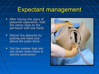 Managing the 3rd stage of labor, dr.rhodora cruz,bulacan ob g | PPT