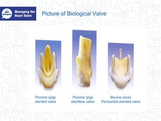 Managing the heart value | PPT | Blood Disorders | Diseases and Conditions