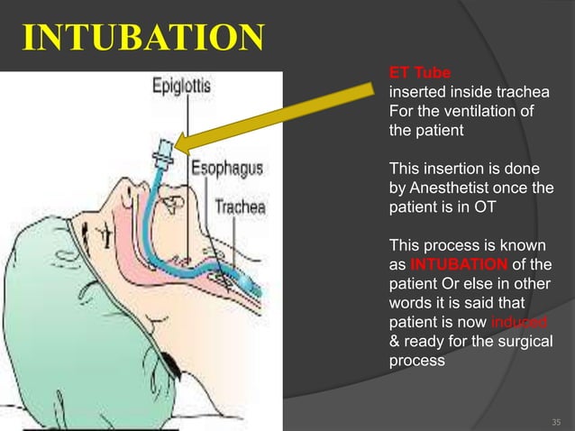 Managment DVR Surgery | PPTX