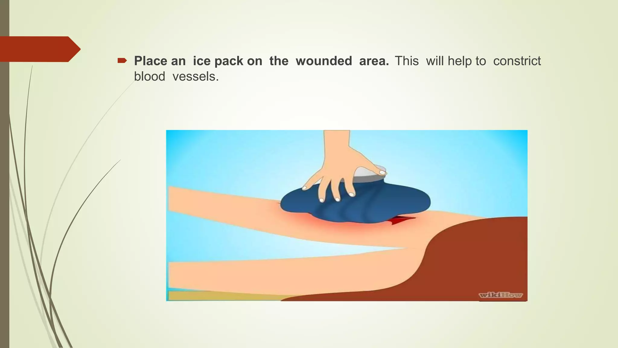 Managment of external venous | PPTX