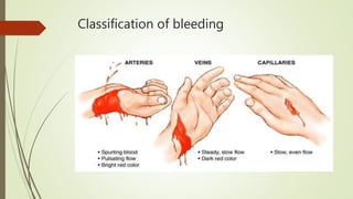 Managment of external venous | PPT