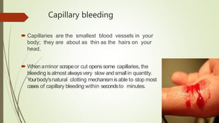 Managment of external venous | PPT