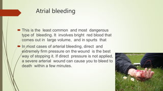 Managment of external venous | PPT