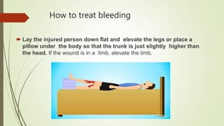 Managment of external venous | PPT