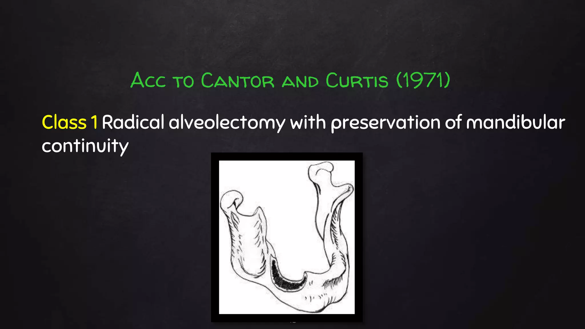 Managment of hamimandibulectomy | PPTX