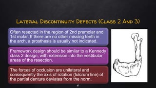 Managment of hamimandibulectomy | PPTX