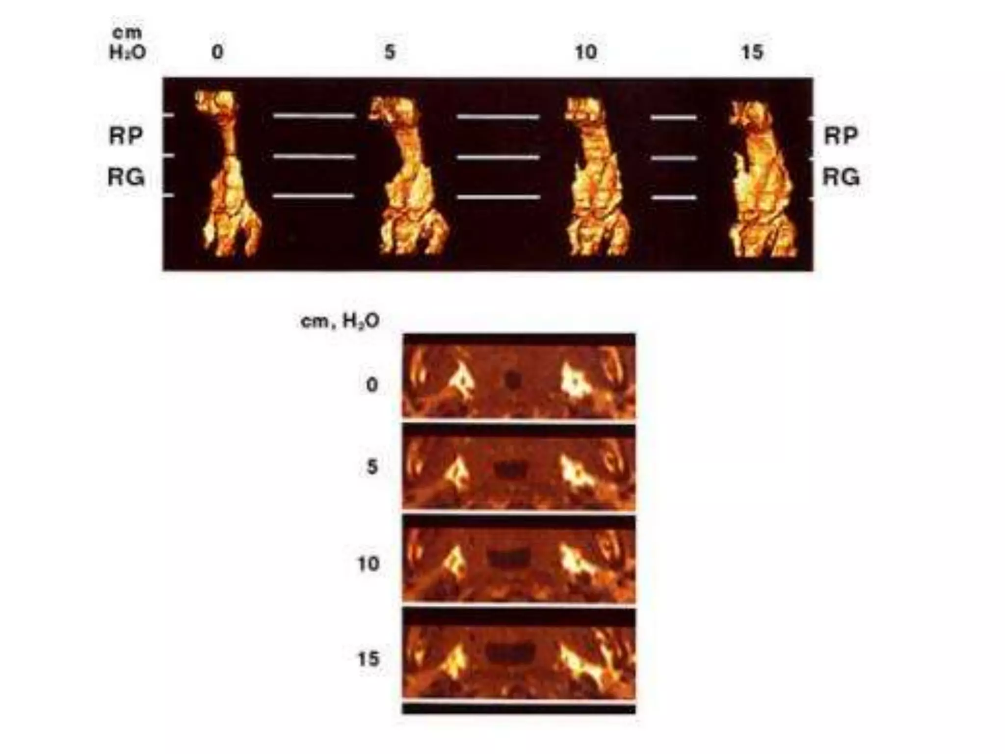 Managment of osa | PPTX