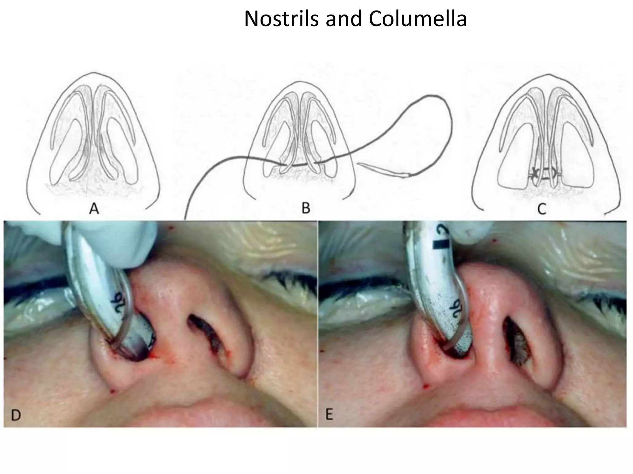 Managment of osa | PPTX