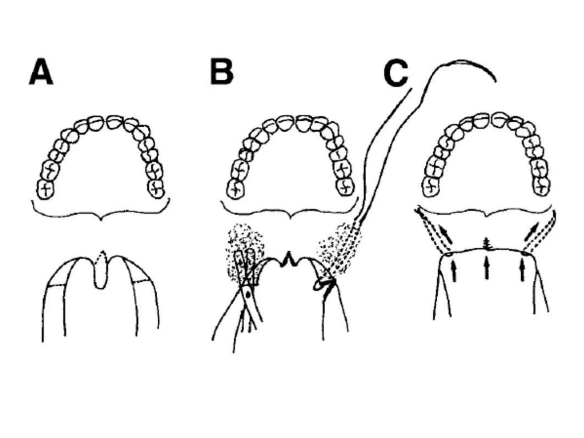 Managment of osa | PPTX