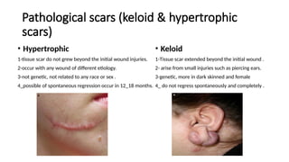 managment of scar in facial area.pptxsss | PPTX