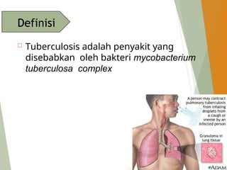 MANAJEMENE PENATALAKSANAAN TUBERCULOSIS.ppt