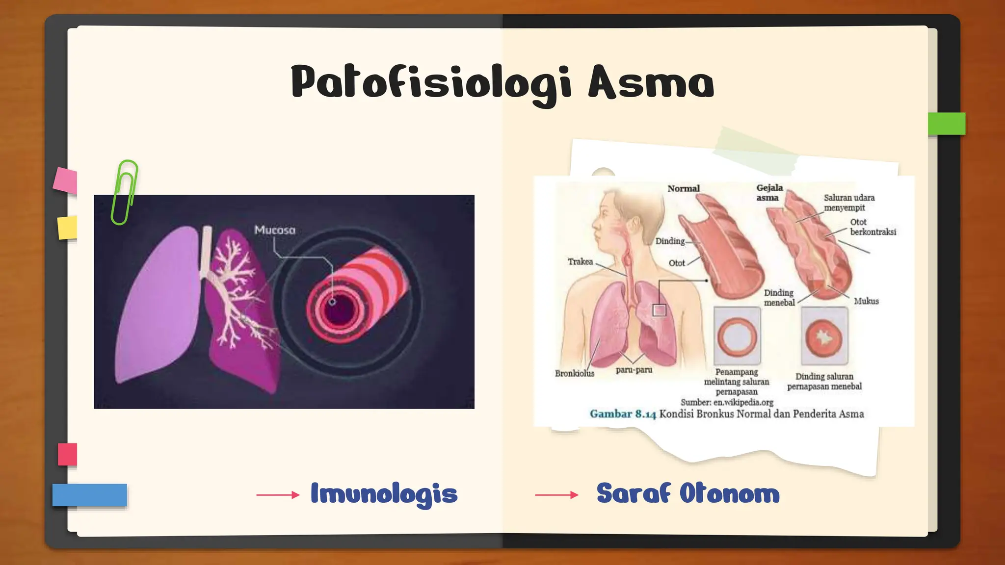 (Manajemen FT Asma).pptx penyakit asma fisioterapi | PPTX