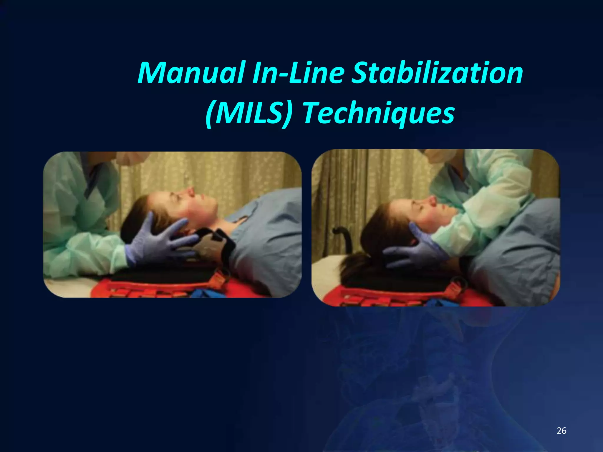 Manajemen Jalan Napas pada trauma Kepala DVN.pptx