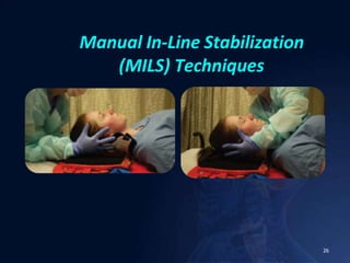 Manajemen Jalan Napas pada trauma Kepala DVN.pptx