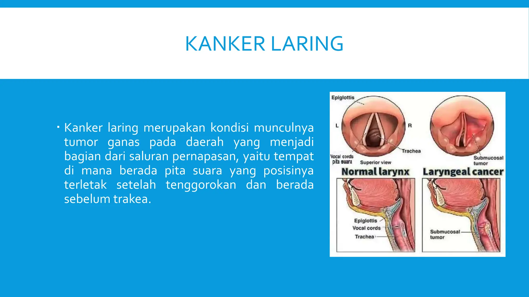 Manajemen Kanker Saluran Pernafasan dan Kegawatdaruratan Pada Pasien 2.pptx