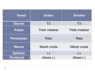 Manajemen kasus tonsilitis | PPTX