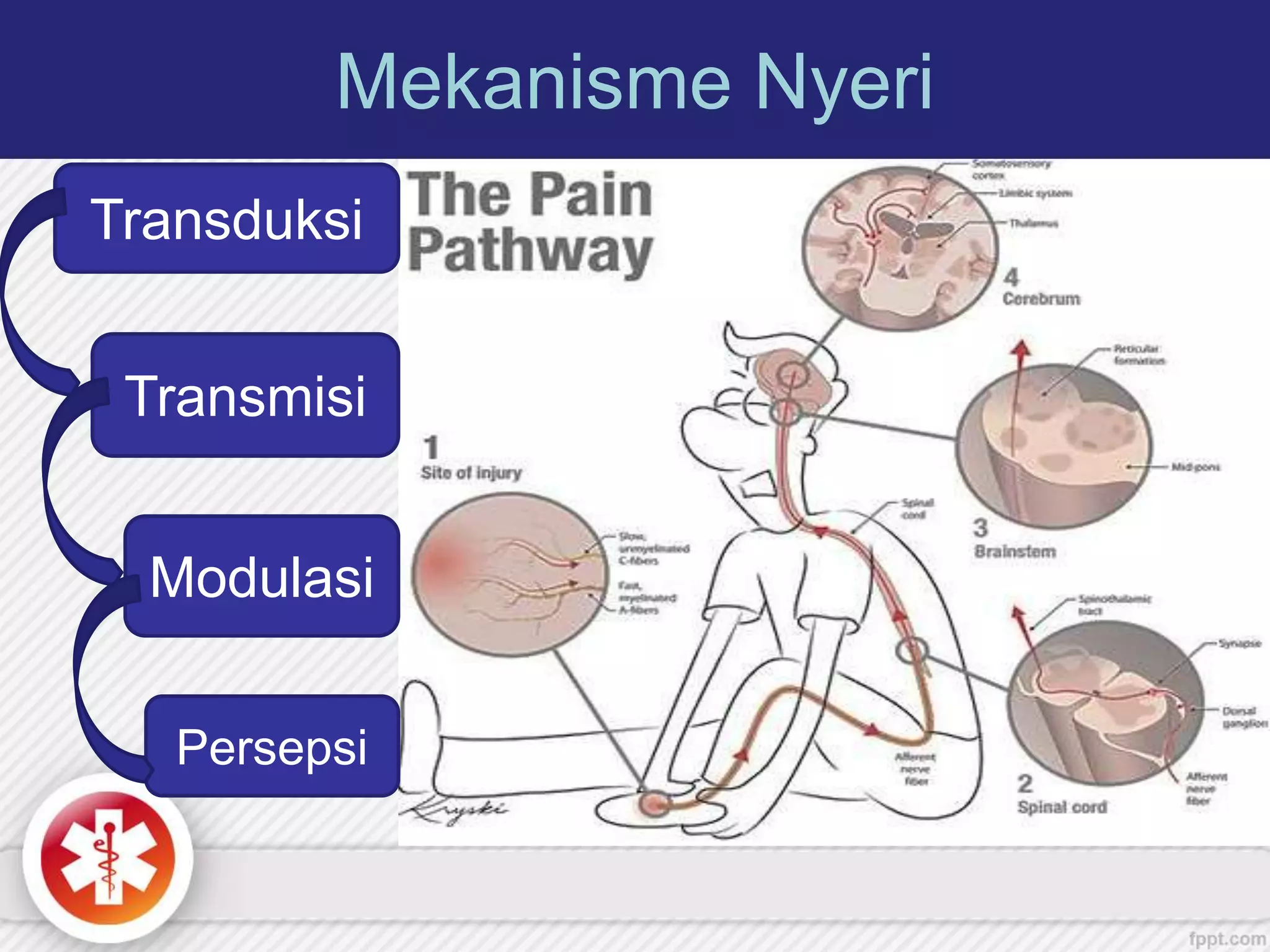Manajemen_Nyeri_ppt.ppt