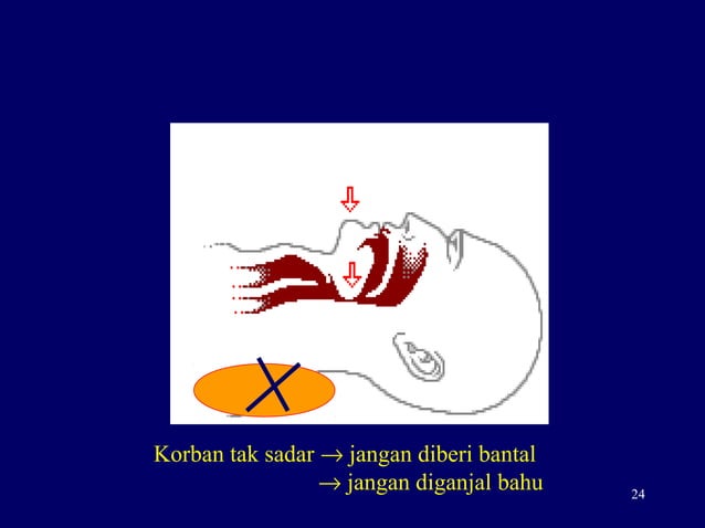 Manajemen sumbatan jalan napas | PPT