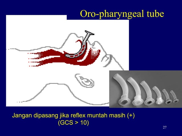 Manajemen sumbatan jalan napas | PPT