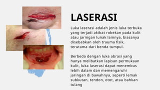 Manajemen Trauma Maksilofasial AKibat Trauma Tumpul.pptx