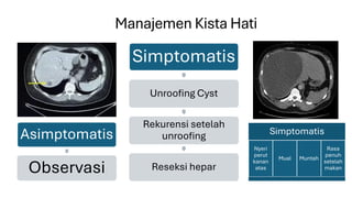 manajemen tumor hati. yg perlu diketapdf | PDF