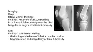 manar files osgood shlutter disease by m | PPT