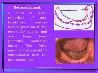 Mandibular edentulous foundation/ dental education in india | PPT