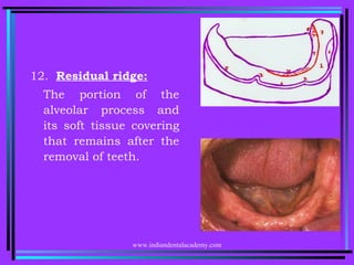 Mandibular edentulous foundation/ dental education in india | PPT