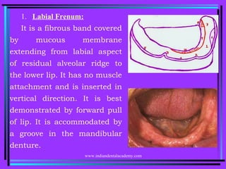 Mandibular edentulous foundation/ dental education in india | PPT