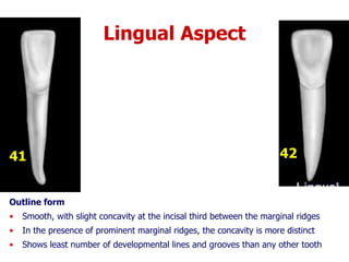 MANDIBULAR CENTRAL INCISOR AND LATERAL INCISORS.ppt