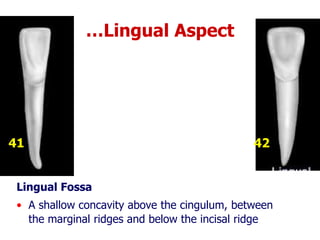MANDIBULAR CENTRAL INCISOR AND LATERAL INCISORS.ppt