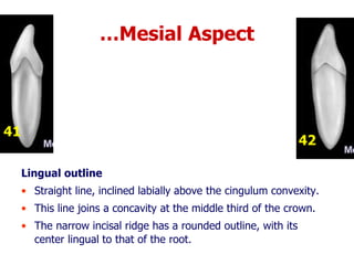 MANDIBULAR CENTRAL INCISOR AND LATERAL INCISORS.ppt