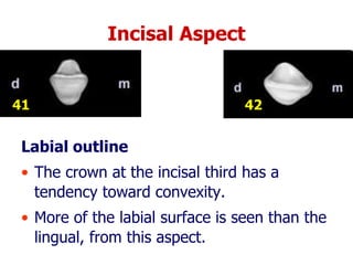 MANDIBULAR CENTRAL INCISOR AND LATERAL INCISORS.ppt