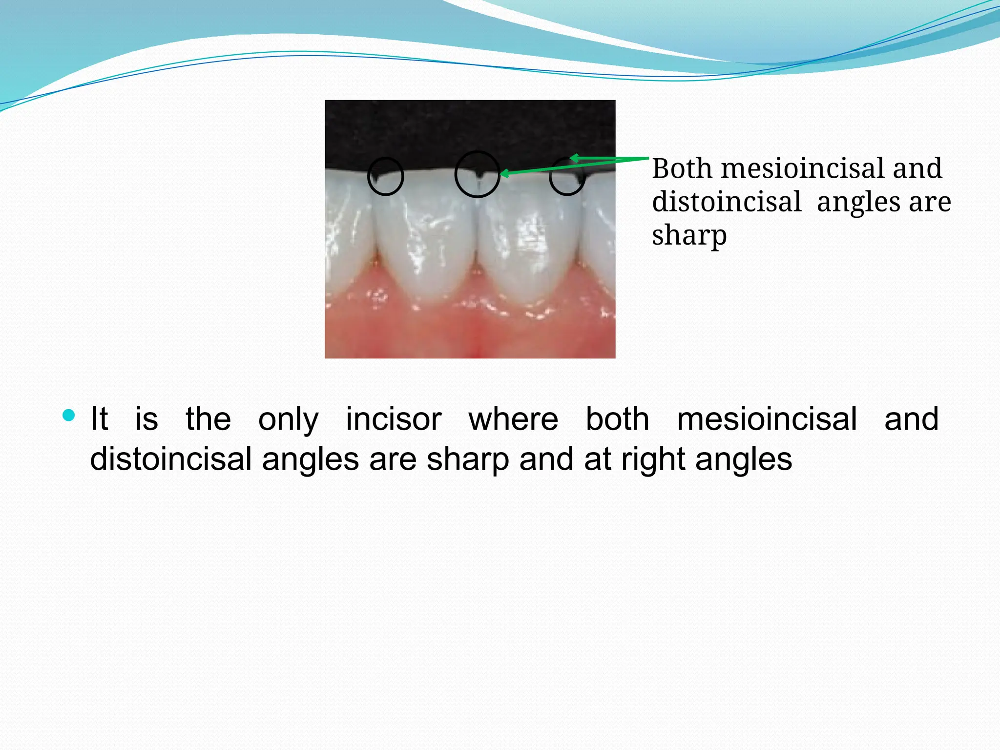 Permananet mandibular lateral incisor c.pptx