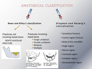 Mandibular fracture introduction i.h | PPTX