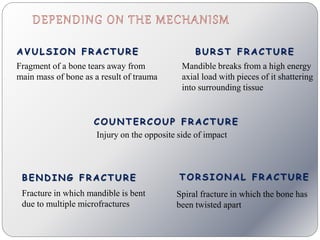 Mandibular fracture introduction i.h | PPTX