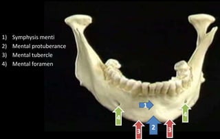 bony features of Mandible | PPTX
