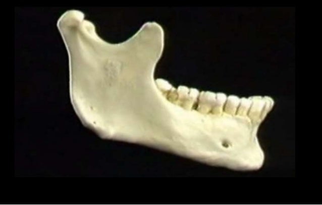 Mandible Mylohyoid Line