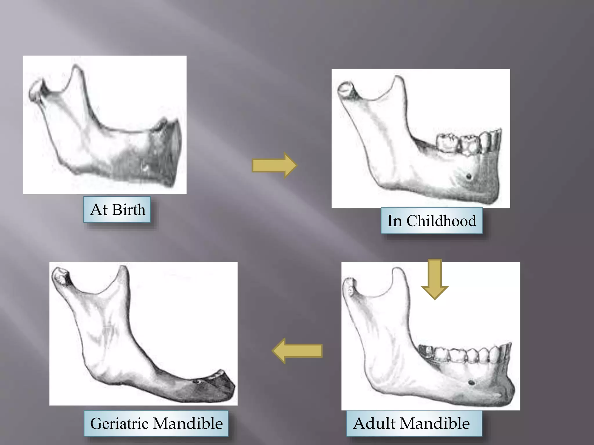ANATOMY,DEVELOPMENT AND CLINICAL CONSIDERATION OF Mandible | PPT