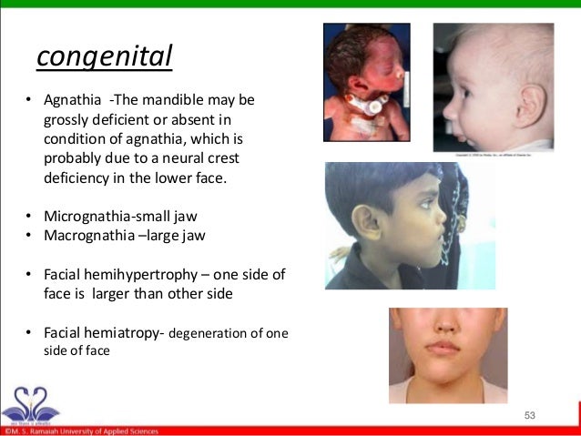 growth and development of Mandible