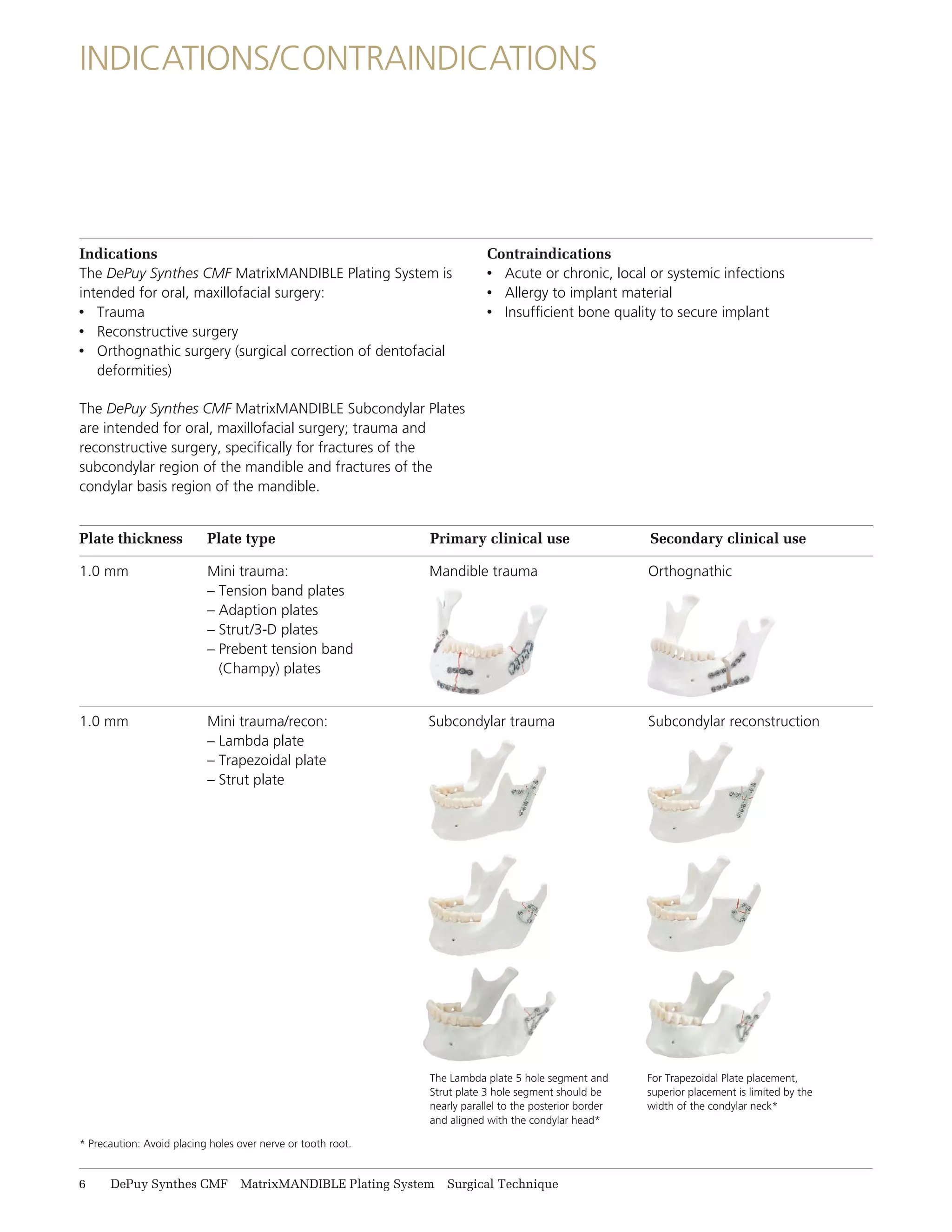maxillofacial surgery implants | PDF