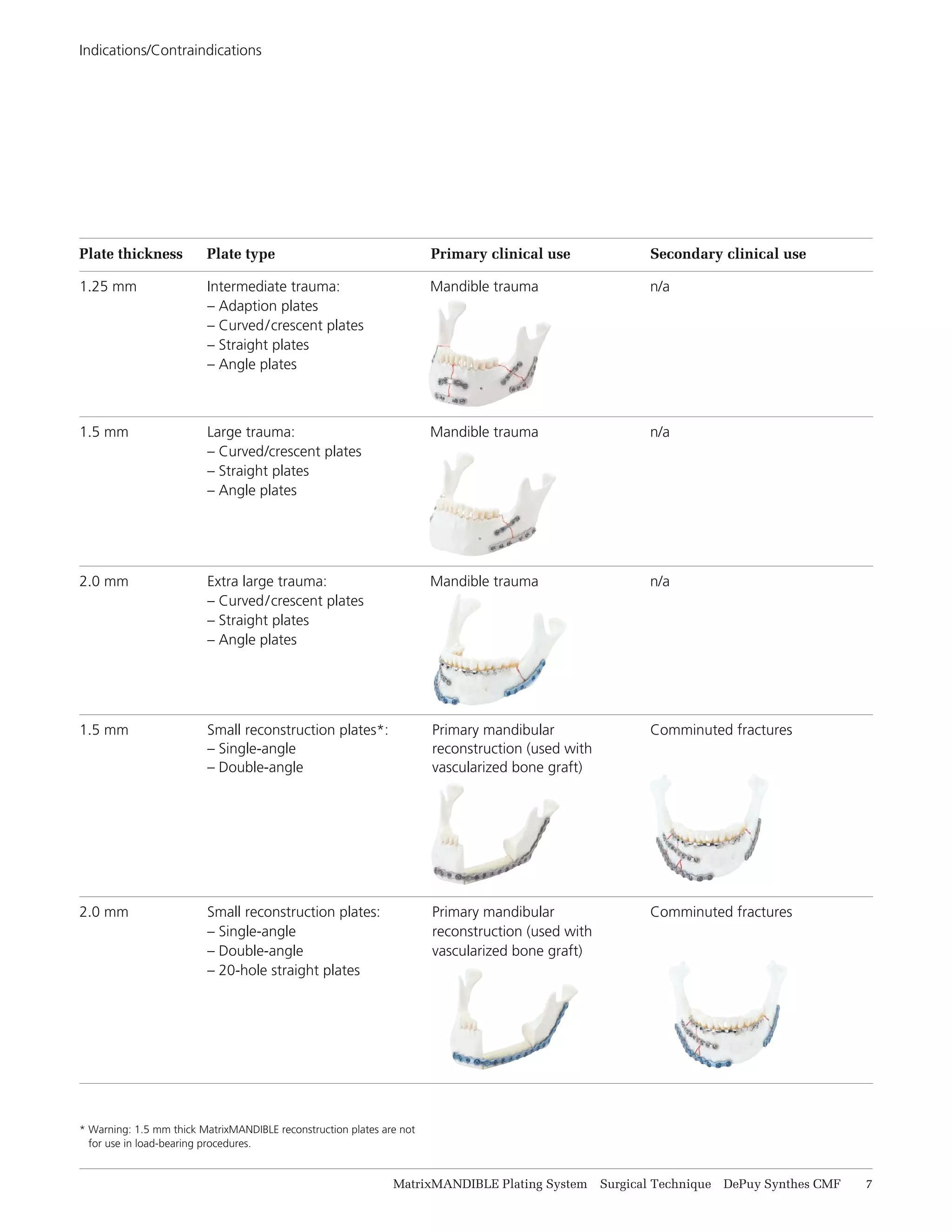 maxillofacial surgery implants | PDF