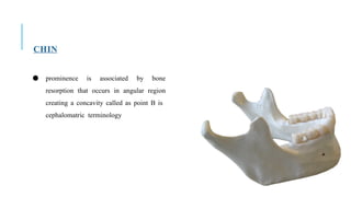 Structural and Functional Overview of the Human Mandible: Anatomy ...