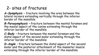 Mandibular fractures and their management | PPTX