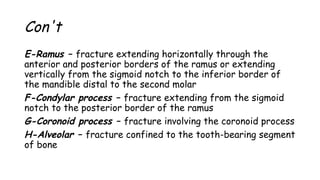 Mandibular fractures and their management | PPTX