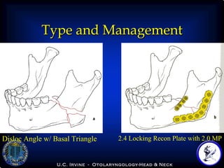 Mandible Fracture 01 31 08 | PPT