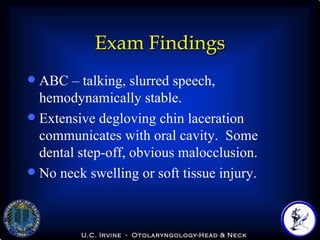 Mandible Fracture 01 31 08 | PPT