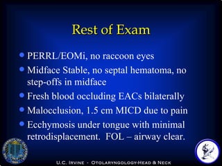 Mandible Fracture 01 31 08 | PPT