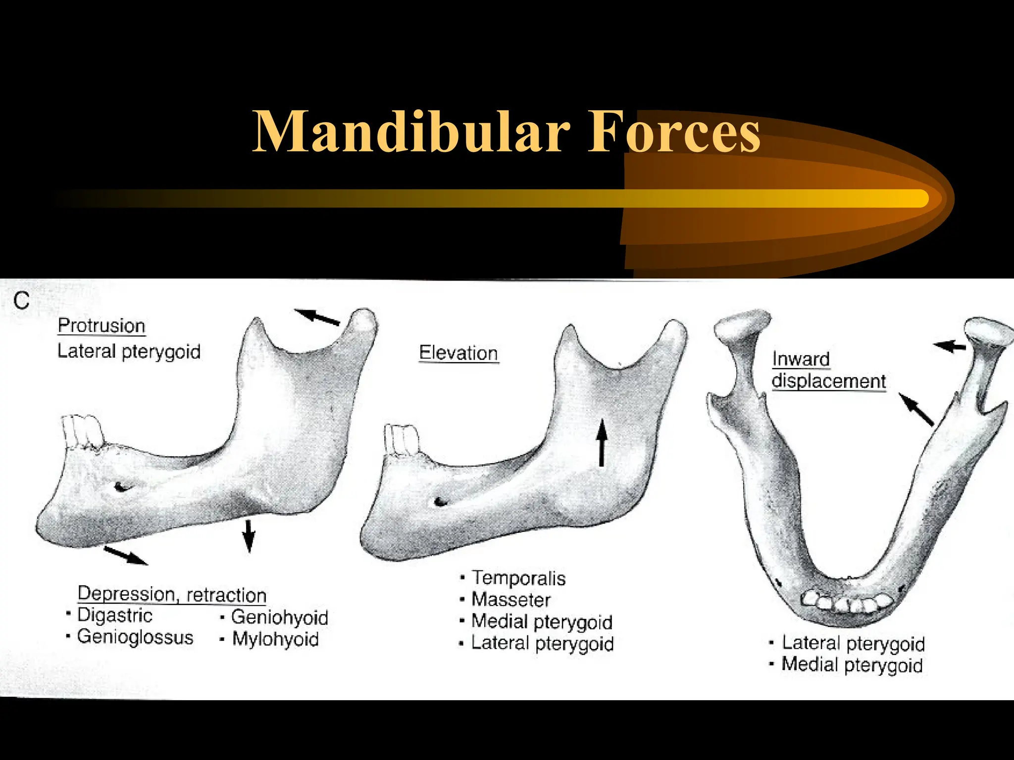 Mandible fracture signs and symptoms ppt | PPT